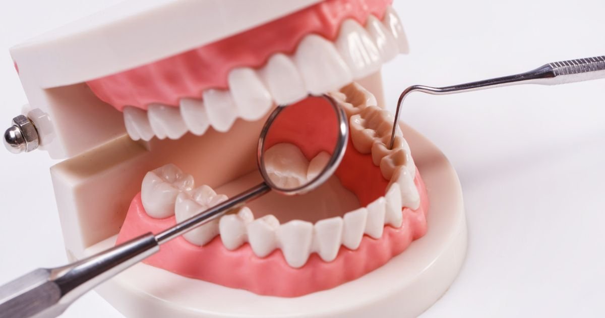Tooth Filling Cost Types And Procedures City Dental Hospital